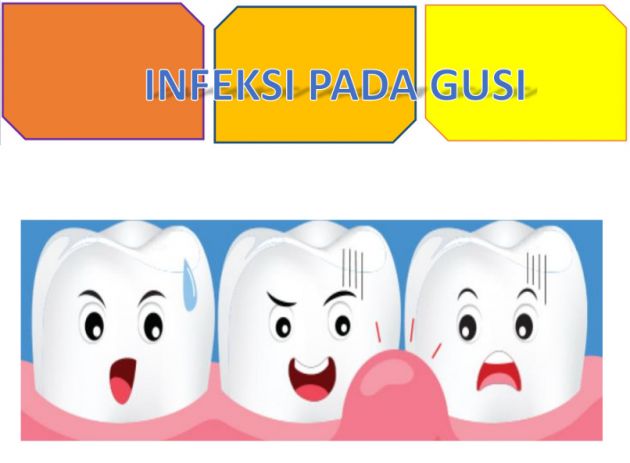 Infeksi Pada Gusi - Universitas Surabaya (UBAYA)